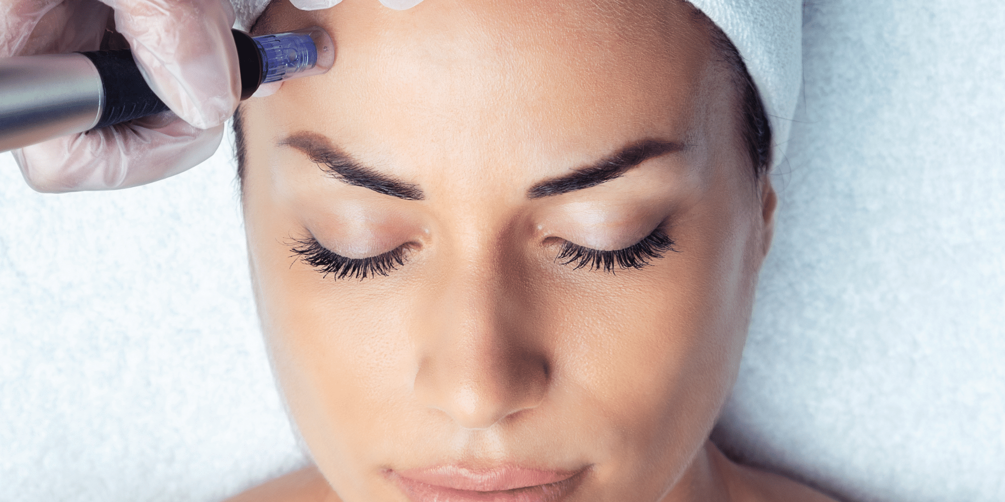 The Complete Guide to Micro Needling: Everything You Need To Know ...